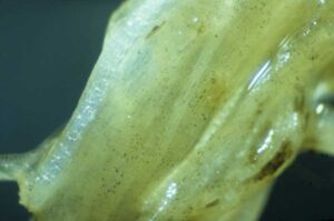 Pathogen Profile: Olpidium brassicae | Healthy Hydroponics